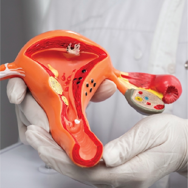 Evalyn Brush HPV Self Collection Kit (Cervical Swab)